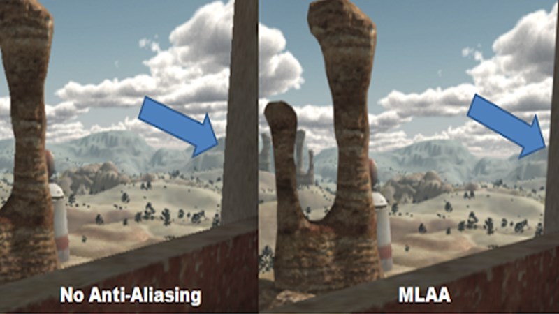 Khử răng cưa là gì? 10 hình thức khử răng cưa phổ biến nhất