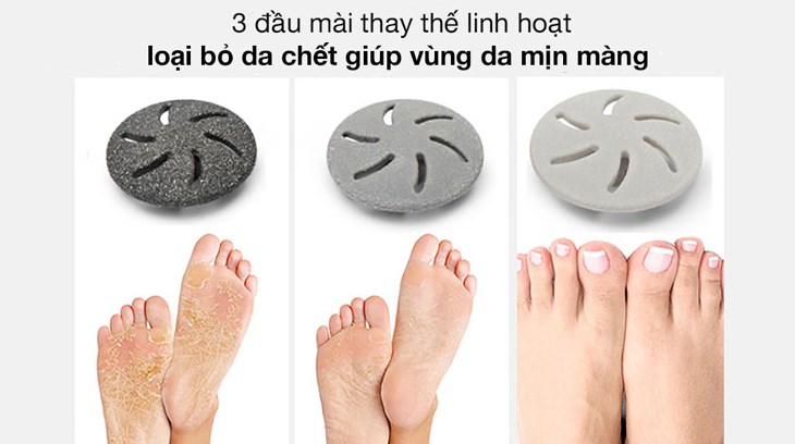 What is a heel scrubber? How many types are there? 4 benefits of a heel ...