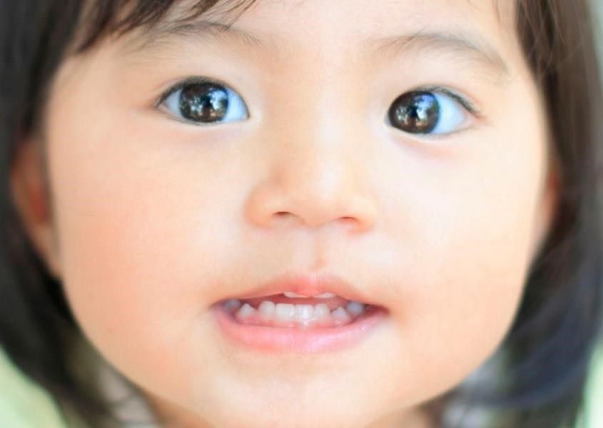 Hình ảnh mắt lác : Những điều thú vị mà bạn chưa biết