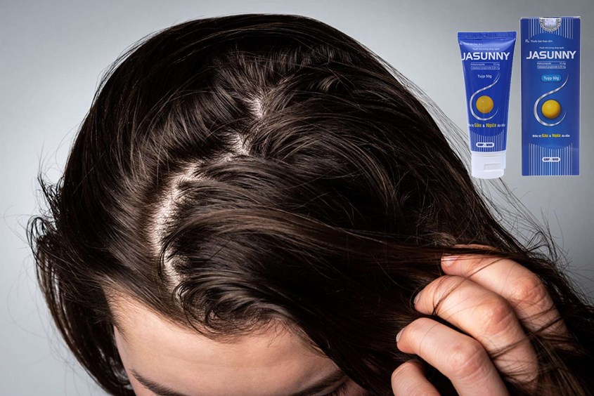 Dầu gội Jasunny có tốt không? Cách sử dụng dầu gội Jasunny hiệu quả