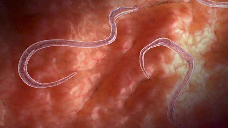 Nhiễm giun kim: Triệu chứng, nguyên nhân và cách điều trị