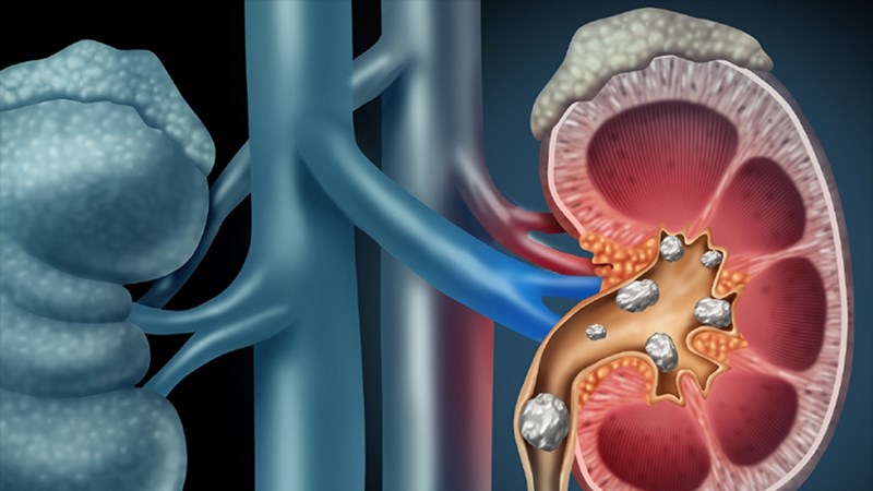 Quả su su có tác dụng gì? 12 tác dụng của quả su su với sức khỏe