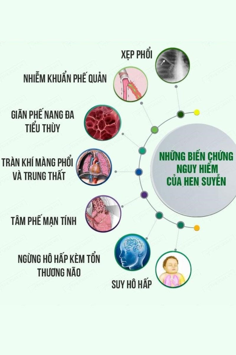 Bệnh hen suyễn có lây không? Tìm hiểu chi tiết và giải đáp thắc mắc