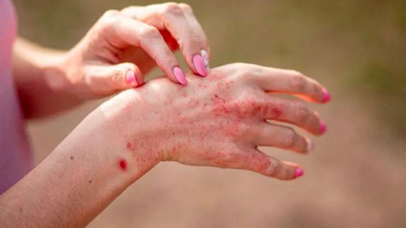 Cây sầu đâu là gì? 9 công dụng điều trị bệnh và lưu ý sử dụng