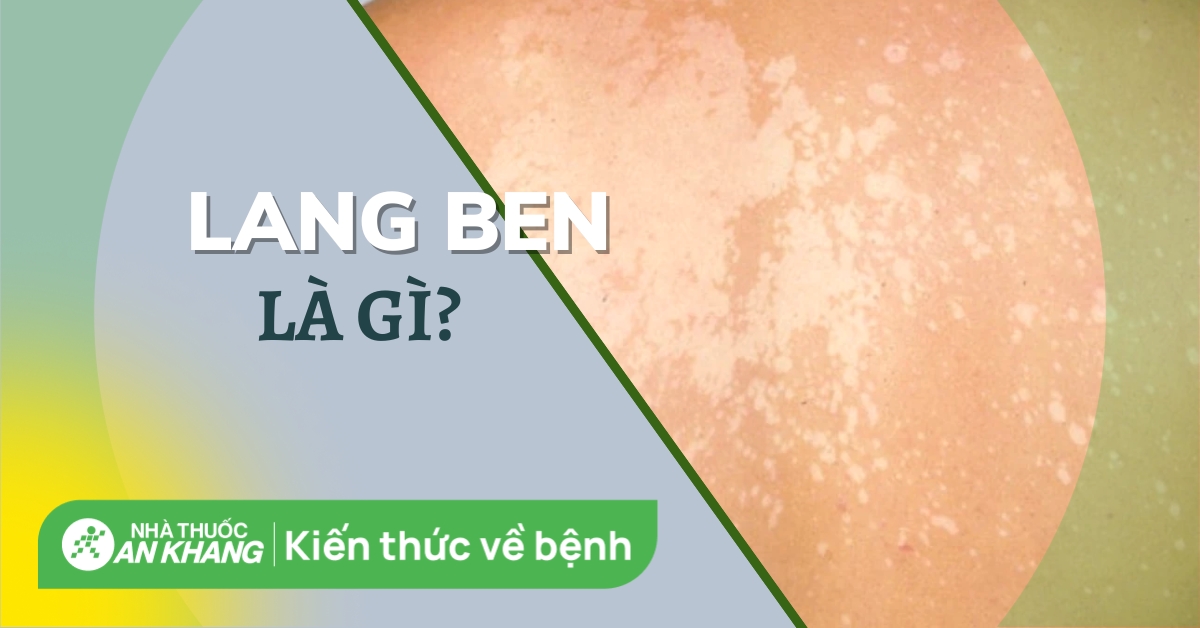 13 cách trị nấm bẹn tận gốc tại nhà, ngăn ngừa tái phát