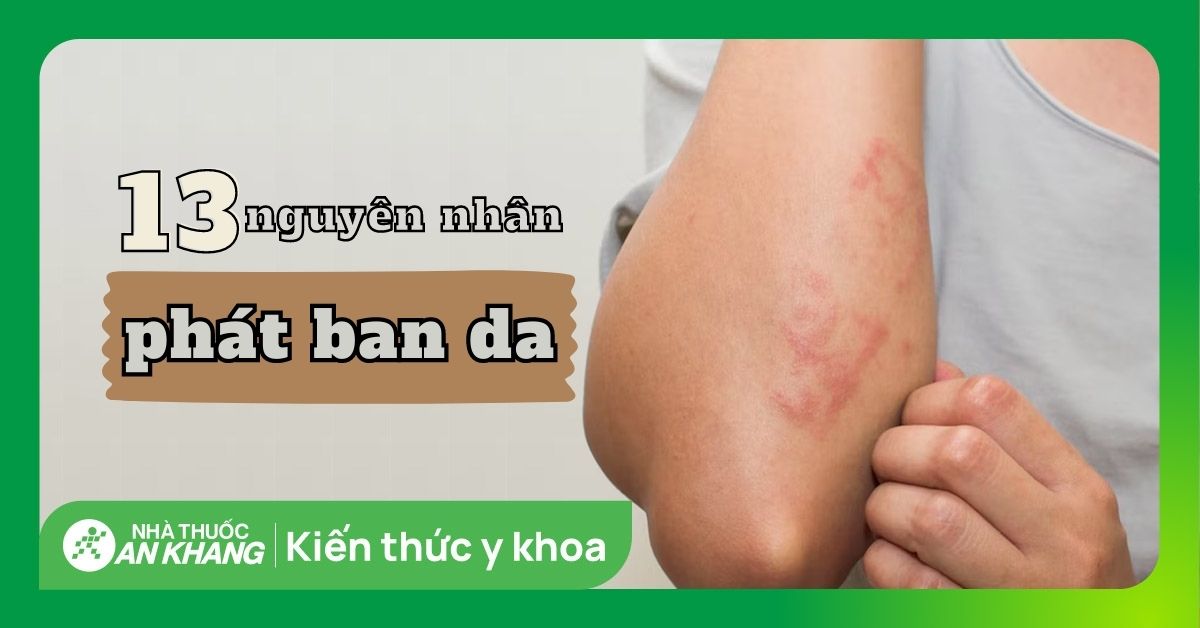 13 nguyên nhân phát ban da và cách khắc phục bạn cần nên biết