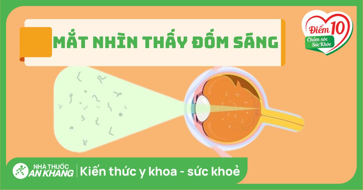 13 nguyên nhân sưng mí mắt và cách khắc phục hiệu quả