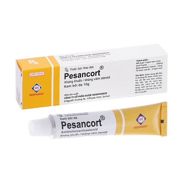 Kem bôi da Esojay 15mg điều trị bệnh vảy nến, viêm da dị ứng tuýp 15g ...