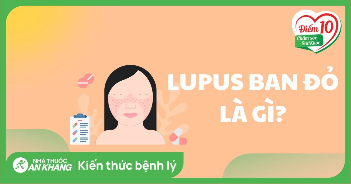 Lupus ban đỏ là gì? Triệu chứng và nguyên nhân