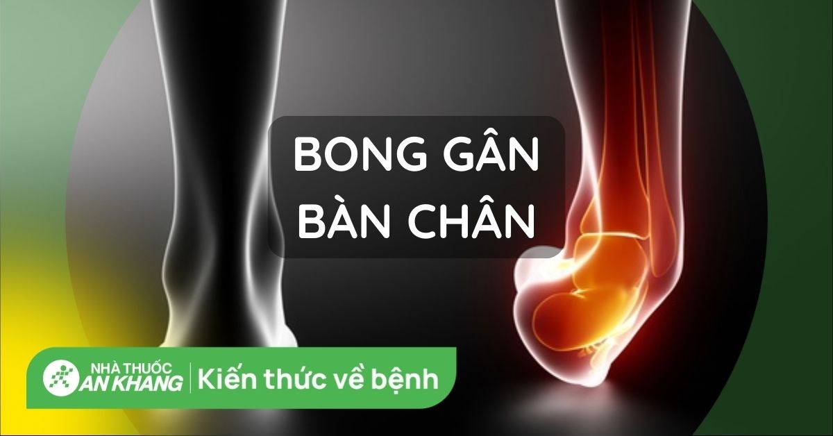 Bong gân bàn chân: Xử trí đúng cách để giảm đau, nhanh lành