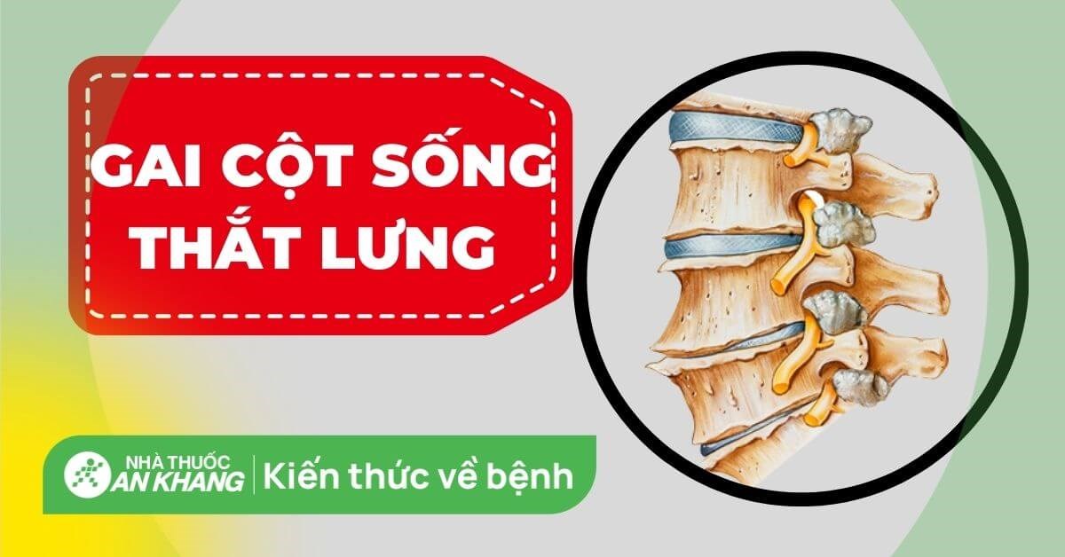 Gai cột sống thắt lưng: Dấu hiệu, nguyên nhân và cách điều trị