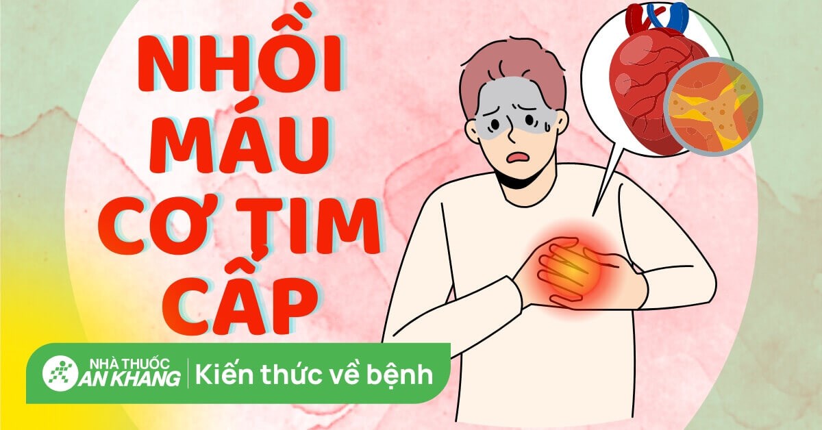 Nhồi máu cơ tim cấp: Dấu hiệu nhận biết và một số phương pháp điều trị