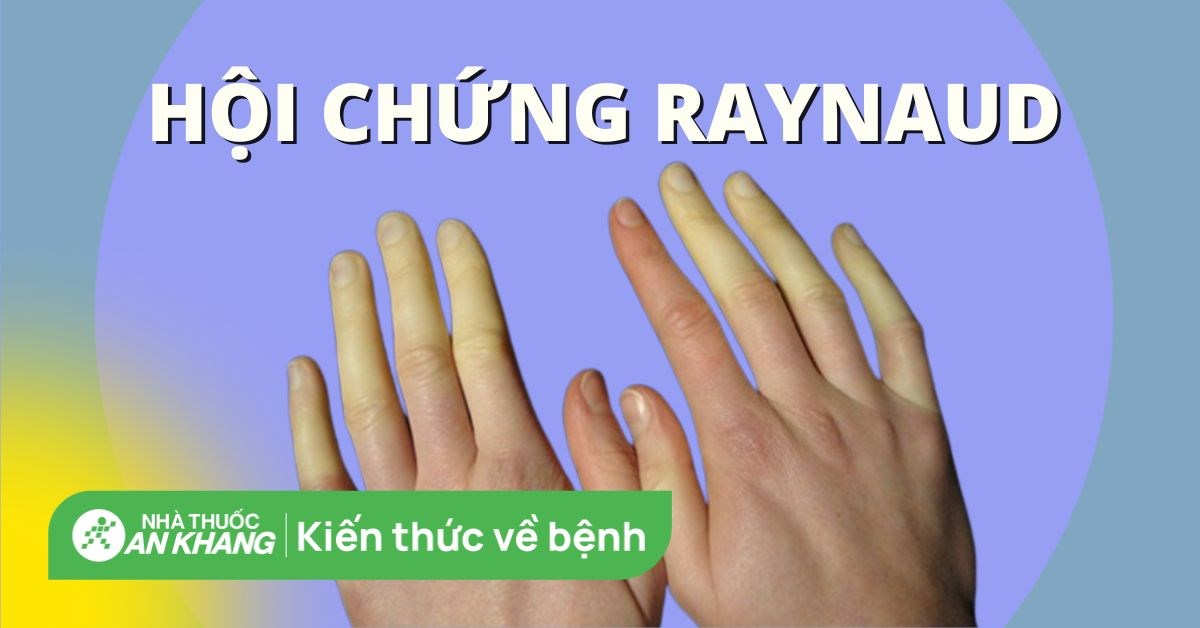 Hội chứng raynaud: Nguyên nhân và cách cách chữa trị hiệu quả
