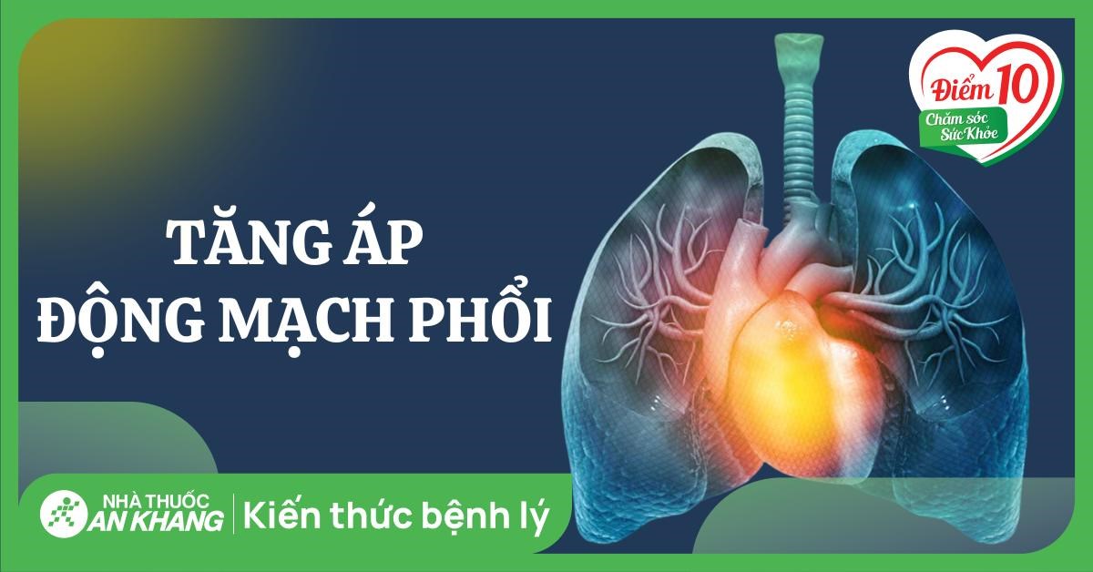 Tăng áp động mạch phổi: Nguyên nhân, triệu chứng và điều trị