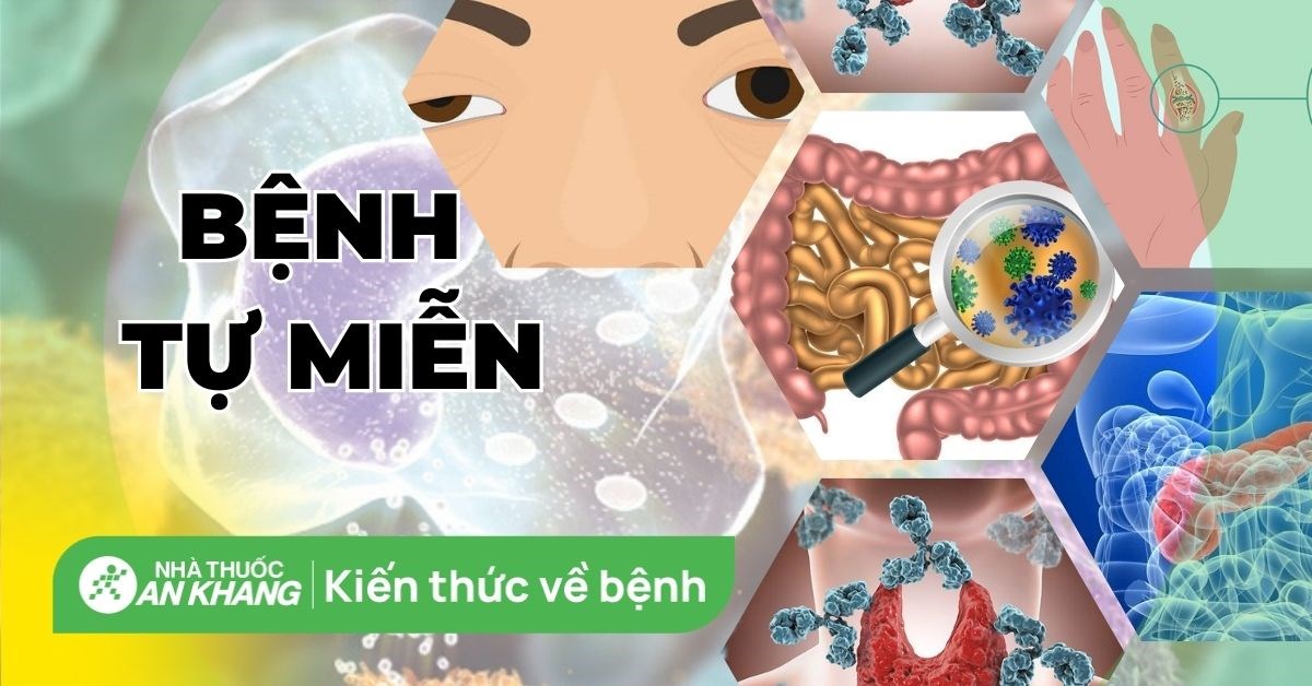 Bệnh tự miễn: Dấu hiệu nhận biết và cách điều trị hiệu quả