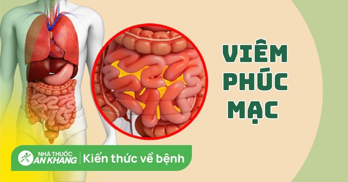 Viêm phúc mạc: Triệu chứng, biến chứng và cách điều trị