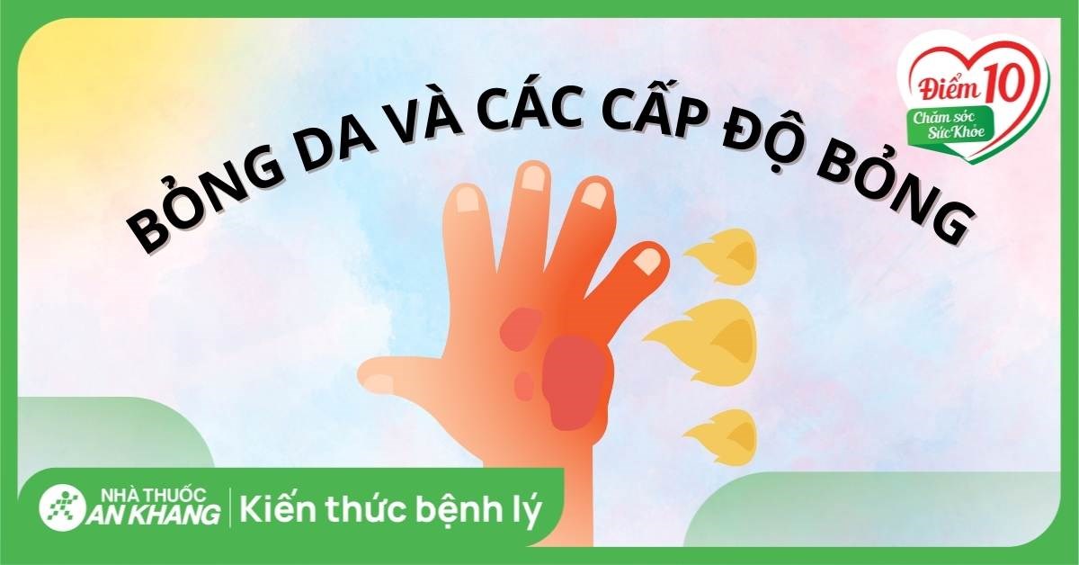 Bỏng da (các cấp độ bỏng da) và hướng dẫn cách xử trí khi bị bỏng
