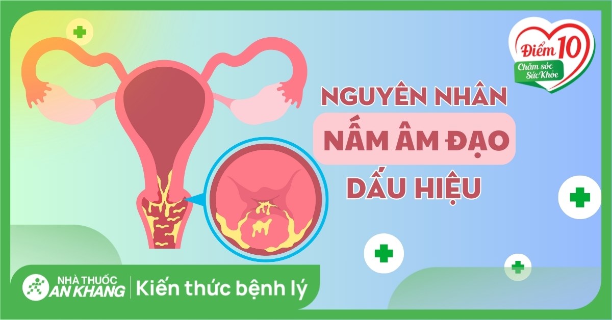 Nấm âm đạo: Nguyên nhân, dấu hiệu, chẩn đoán, điều trị