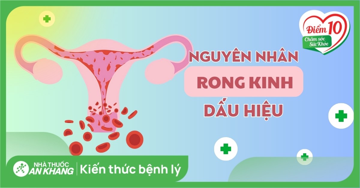 Rong kinh: Dấu hiệu, nguyên nhân và cách điều trị hiệu quả