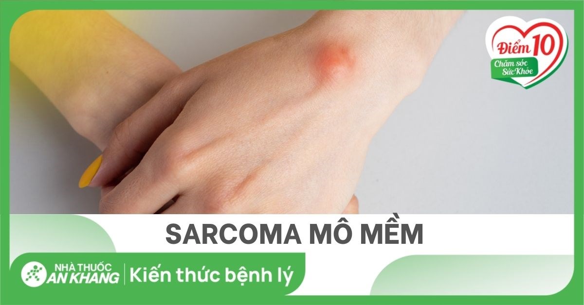 Sarcoma mô mềm là gì? Dấu hiệu nhận biết và cách điều trị