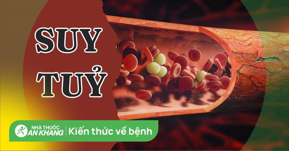 Suy tủy xương : Nguyên nhân, dấu hiệu và cách điều trị