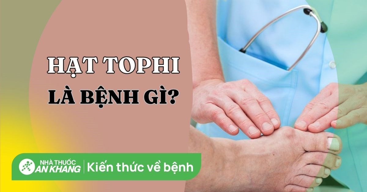 Hạt tophi xuất hiện vì sao? Nguyên nhân, biến chứng và cách điều trị